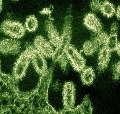 How the 1918 Spanish Flu pandemic ended