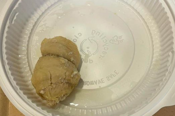 PHOTOS | Disgusting meals served to NSW hospital patients