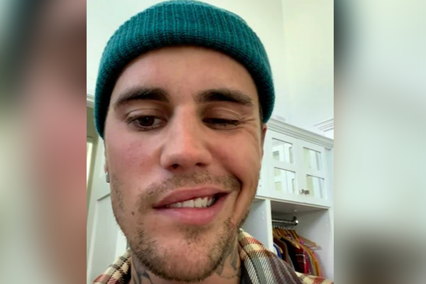 Rare and misdiagnosed condition in the spotlight after Justin Bieber ...