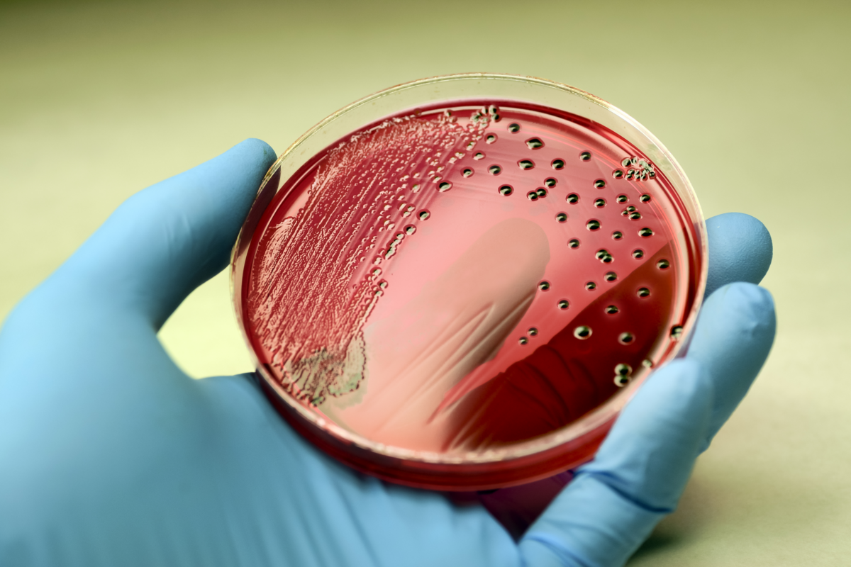 'Microscopic bacteria': Sepsis study to power new antibiotic discoveries